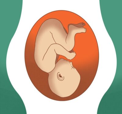 5 positions du bébé pendant la grossesse et leur signification - ÊTRE ...